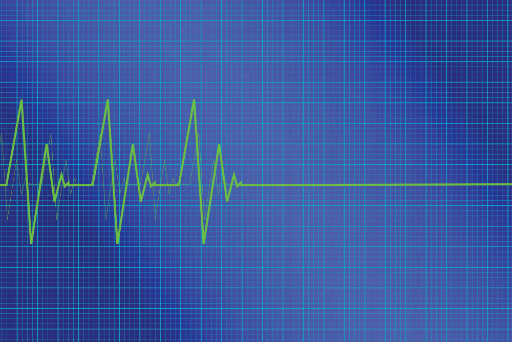 Has an Inmate Completed His Life Sentence if He 'Dies' But Is Then ...